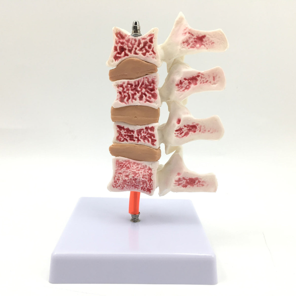 Enlarged Typical Vertebrae Models – scrubz.com