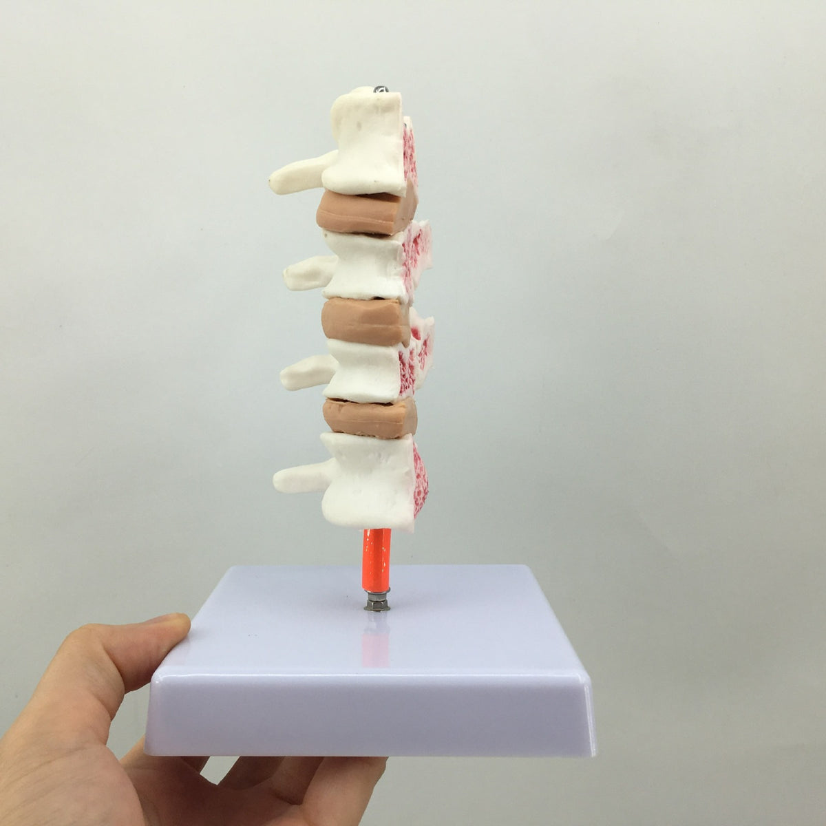 Enlarged Typical Vertebrae Models – SCRUBZ